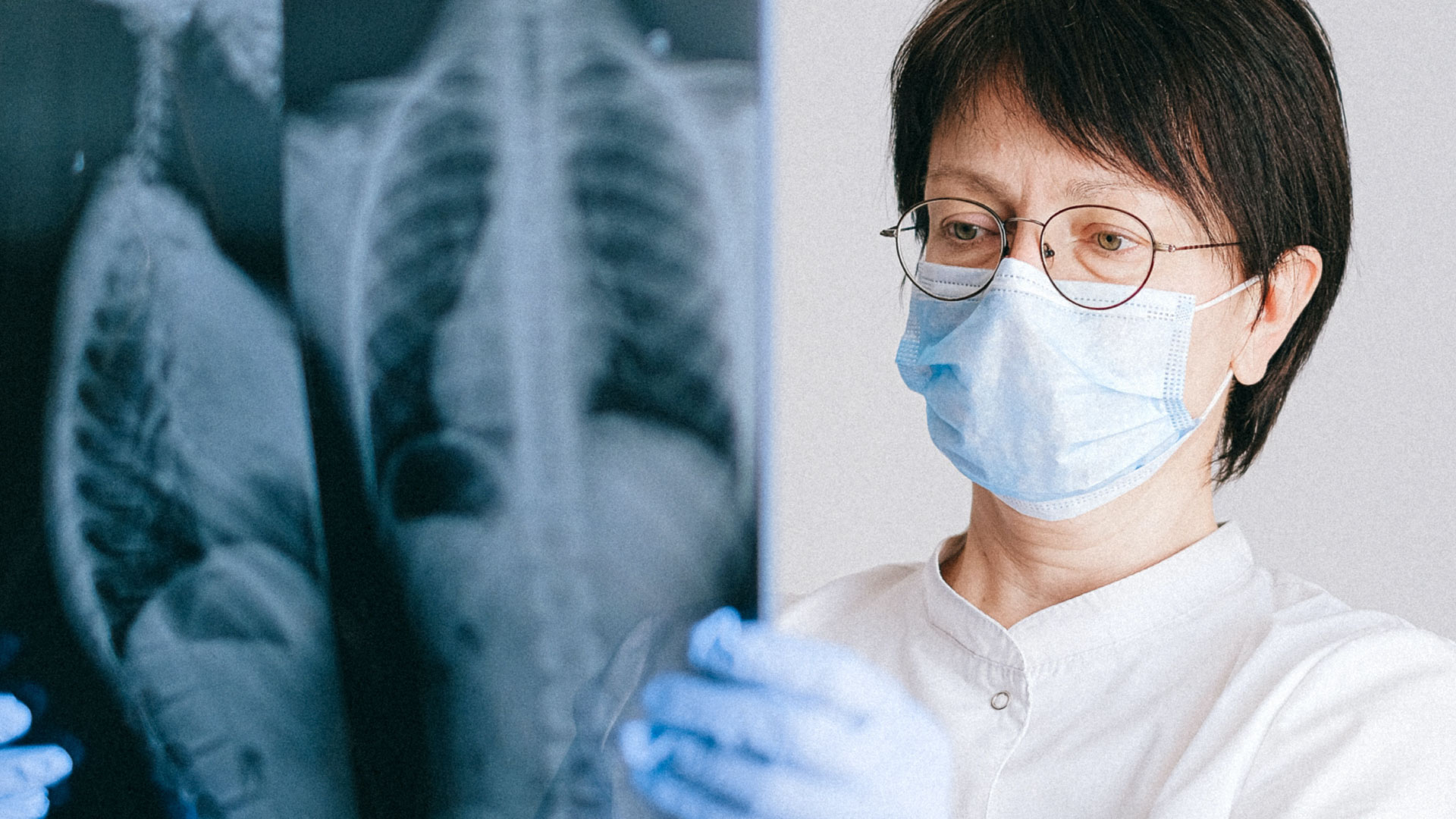 Kither Biotech: molecole per fibrosi cistica e idiopatica polmonare